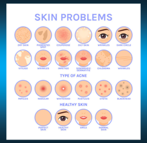 Skin conditions, Rashes – AdventHealthGroup